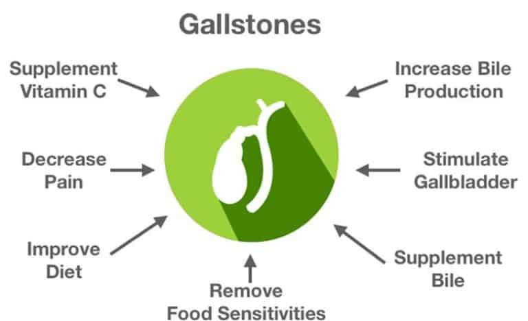 Natural gallstones treatments in Guelph - Guelph Naturopathic Medical ...